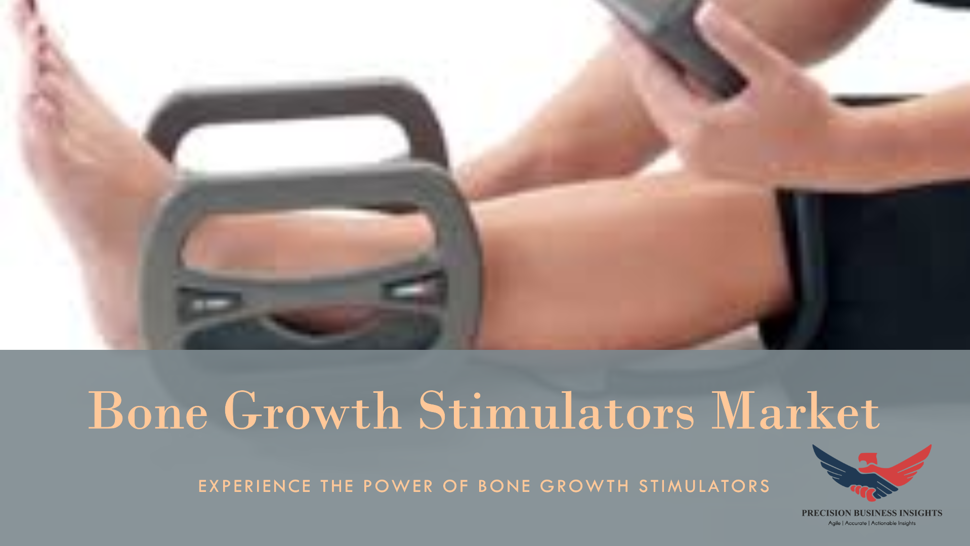 Bone Growth Stimulators Market Dynamics, Key Developments and Size ...
